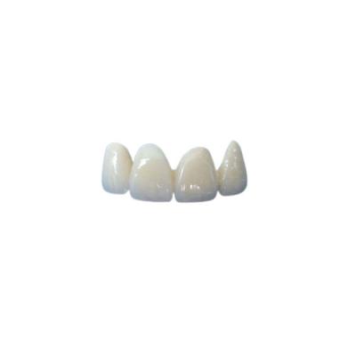 China Good Stability Ceramic Dental Crown Fit Properly Oral Hygiene High Quality for sale
