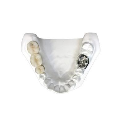 China The Color Of The Porcelain Crown Is Stablenot And Has Strong Stability for sale