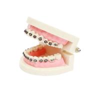 China Porcelain Dental Crown Acid And Alkali Resistance Good Biocompatibility for sale