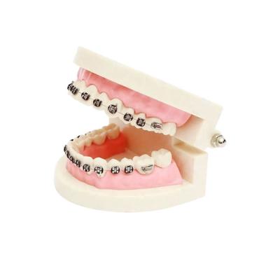 China Porcelain Dental Crown Acid And Alkali Resistance Good Biocompatibility for sale