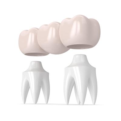China All-Ceramic Crown Appearance And Hardness Closest To Real Teet Transparent Gloss for sale