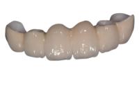 China Smooth Surface Porcelain Dental Crown Restore Chewing Power Good Stability for sale