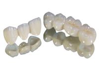 China Porcelain Tooth Crown Strong Wear Resistance Color Stable High Quality for sale