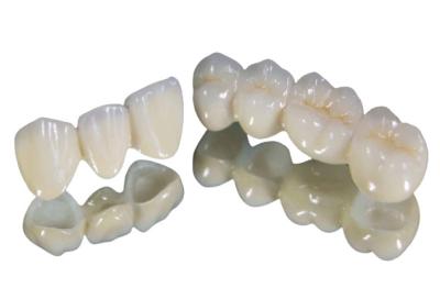 China Porcelain Tooth Crown Strong Wear Resistance Color Stable High Quality for sale