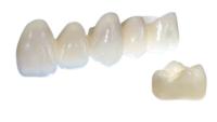 China Porcelain Crowns Are Beautiful In Shape Lifelike In Color And Strong In Stability for sale