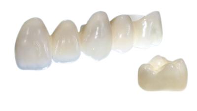 China Porcelain Crowns Are Beautiful In Shape Lifelike In Color And Strong In Stability for sale
