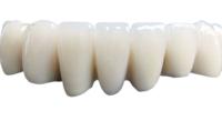 China Beautiful Porcelain Dental Crown Not Easy To Wear Acid And Alkali Resistance for sale