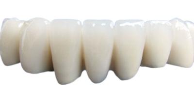 China Beautiful Porcelain Dental Crown Not Easy To Wear Acid And Alkali Resistance for sale
