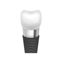 China Superior Durability And Functionality Of Dental Implant Bars for sale