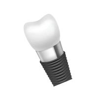 China Dental Implant Bars: Unparalleled Strength And Stability for sale