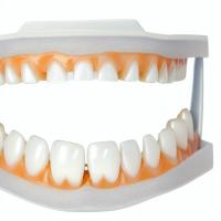 China Standard Polished Stainless Steel Fixed Orthodontic Appliances for sale
