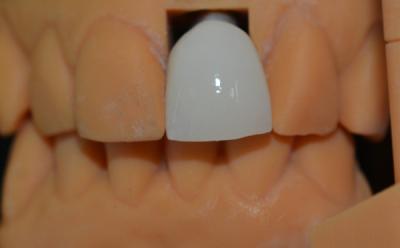 China Enhance Your Lab s Efficiency with High-Durability Dental Prosthetic Lab for sale