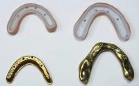 China Full Zirconia Bridge With Titanium Bar Support, Long-lasting Titanium Bar Supported Zirconia Crowns With Bridges for sale