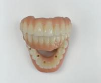 China Easy Cleaning Precise Fit CAD CAM Zirconia Dental All On Restorations Providing Durable and Comfortable Dental Solutions for sale