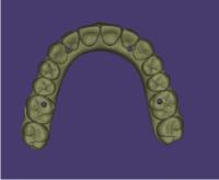 China Design AOX Professional Full Arch Implant Bridge Design Service for sale