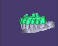 China Design AOX Professional Full Arch Implant Bridge Design Service for sale