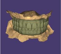China Design AOX Professional Full Arch Implant Bridge Design Service for sale