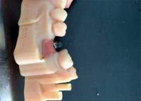 China CAD / CAM PFM Dental Crowns Bridge Resin Material Good Biocompatibility Stability for sale