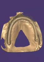China Customized 3D Model Zirconia Crown Offering Long-lasting Durability Designed To Meet The Needs Of Dental Professionals And Laboratories for sale