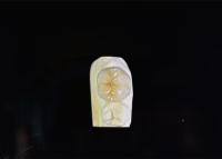China Super Strength Porcelain Dental Crown High Biological Intermiscibility for sale