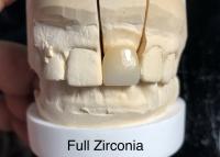 China 3D multi-level Full contour Zirconia Solve the problem of no transparency for sale