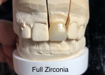 China 3D multi-level Full contour Zirconia Solve the problem of no transparency for sale