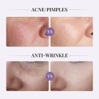 China OEM ODM Collagen Anti Wrinkle Firming Serum 100000 Bottles MOQ Private Label for sale