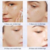 China Professional 3-Step Skincare System with Niacinamide and Vitamin C - 30ML to 120ML Sizes for OEM/ODM for sale