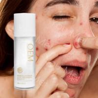 China 50g Herbal Extract Acne Treatment Essence with 36 Month Shelf Life for OEM/ODM Skincare Manufacturing for sale