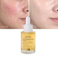 China OEM Hydrating Serum with 5% Niacinamide and 2% Salicylic Acid for Anti-Aging and Pore Minimizing for sale