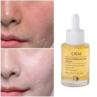 China OEM Hydrating Serum with 5% Niacinamide and 2% Salicylic Acid for Anti-Aging and Pore Minimizing for sale