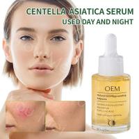 China OEM Hydrating Serum with 5% Niacinamide and 2% Salicylic Acid for Anti-Aging and Pore Minimizing for sale