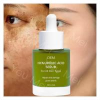 China Tea Tree AHA Vitamin E Face Serum with 25% Tea Tree Extract and Hyaluronic Acid for Acne & Wrinkle Care for sale