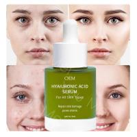 China Tea Tree AHA Vitamin E Face Serum with 25% Tea Tree Extract and Hyaluronic Acid for Acne & Wrinkle Care for sale