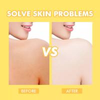 China Custom Shea Butter Body Lotion with Glycolic Acid Peptides Tranexamic Acid 200ml OEM ODM for sale