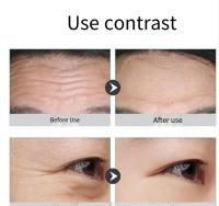 China Customizable Anti-Aging Lactic Acid Bacteria Essence Serum 10ml with Hyaluronic Acid and Retinol for sale