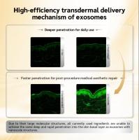China OEM ODM Turmeric EV Anti-Aging Serum Fibroblast Activation Wrinkle Reduction 30ml for sale