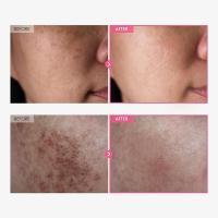 China OEM ODM Arbutin 7% Tranexamic Acid 4% Face Cream 70000ppm Whitening Anti-Aging Customizable for sale