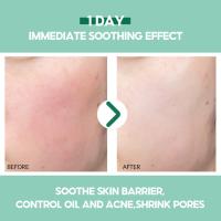 China OEM ODM customized Aloevera gel, a Korean private brand, organically soothes 99% pure aloe moisturizing face cream, moisturizes, moisturizes and tender skin for sale