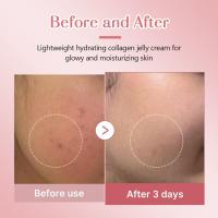 China OEM ODM Korean version collagen facial moisturizing cream, vitamin E facial jelly cream, skincare products, plump wrinkles, firm skin for sale