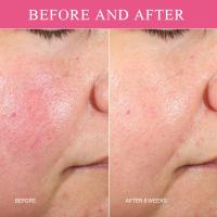 China OEM ODM Brand Custom Luxury Whitening Skincare Essence Micro Pearl Essence for Women Rose Face Anti-Aging Whitening Facial Essence Product for sale
