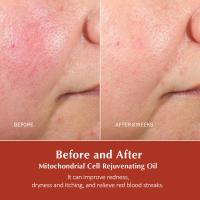 China OEM ODM brand customized liquid double tube essence hyaluronic acid mitochondrial cell anti-aging anti wrinkle moisturizing repair skin care product for sale