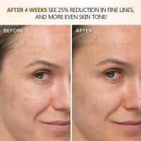 China OEM ODM Brand Customized Retinol Alpha Hydroxy Acid Face Cream Brightening Nourishing Anti-Aging Facial Hydrating Skin for sale