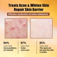 China OEM ODM Korean brand customized skin care products 99% particles 15um whitening anti acne repair facial essence for sale