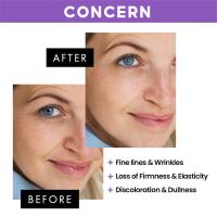 China OEM ODM Brand Skincare Bakuchiol Facial Serum Soothing Wrinkle-Removing Anti-Aging Lifting Brightening Facial Serum Essence for sale