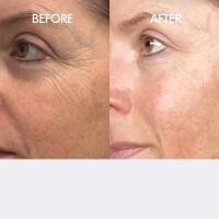 China OEM ODM Brand Anti Aging Vitamin C Facial Serum Caviar Moisturizing Agent Anti Wrinkle Tightening Skincare Liquid Facial Serum for sale