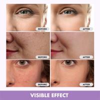 China OEM ODM Brand Serum essence Natural Bifida Fermented Lysate Antioxidant Anti aging Skin Care Serum Skin Care Slimming&Whitening Facial essence for sale