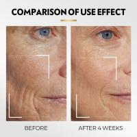 China OEM ODM Brand Customized Skincare Set SPF 30 Day Cream Night Cream Firming Skincare Anti-Aging Anti-Wrinkle Tightening Essence & Lotion Facial Moisturizer Set for sale
