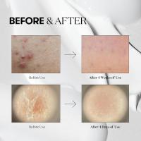 China OEM ODM Korean brand natural skin care products Microneedle serum Centalla soothing repair skin care products Face essence for sale