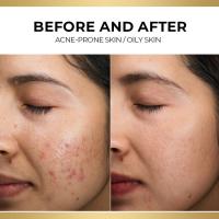 China OEM ODM brand organic natural anti-aging and wrinkle resistant facial skincare serum Exosome collagen hyaluronic acid moisturizing and smoothing serum for sale